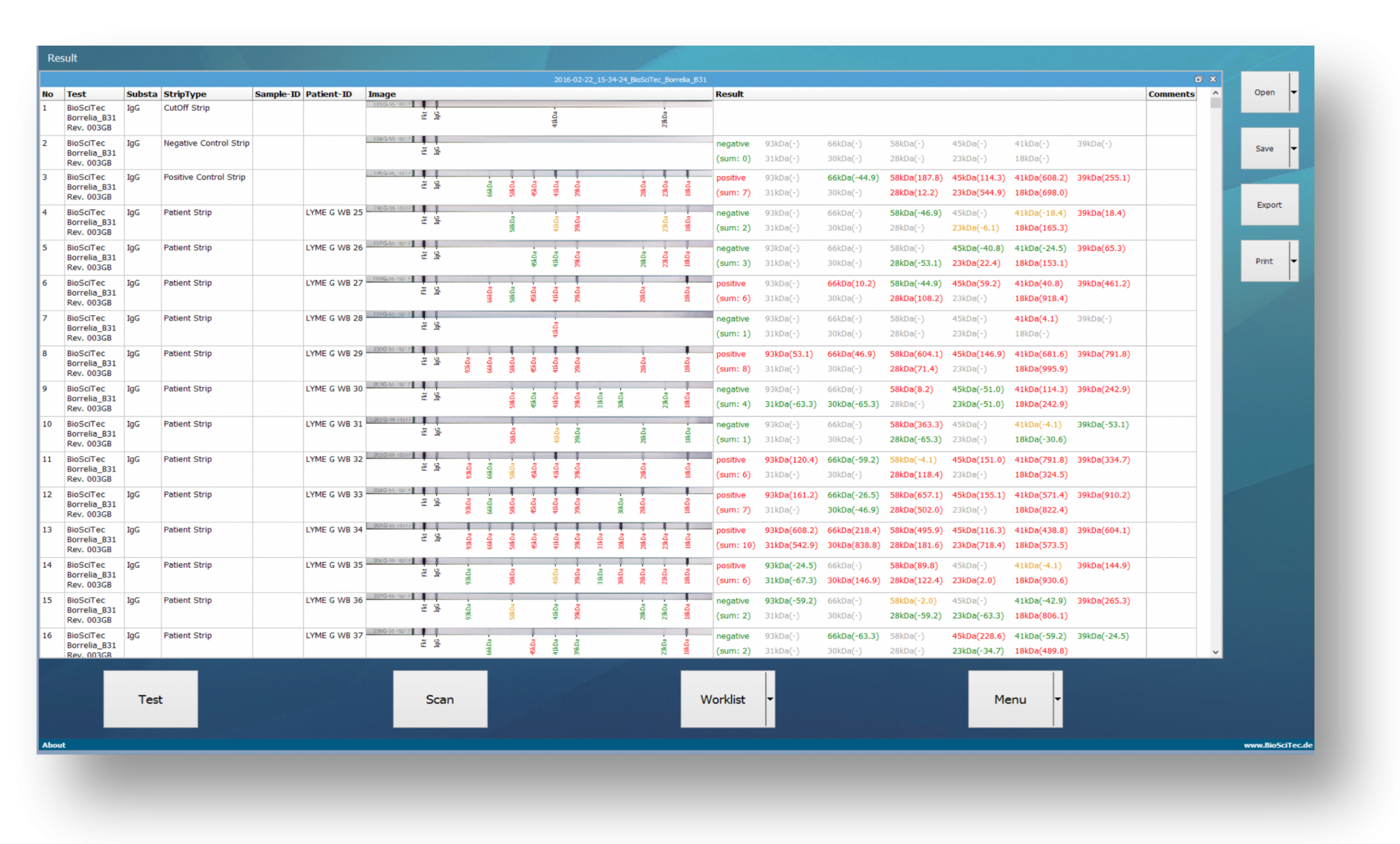B4C Strip Analysis – BioSciTec GmbH